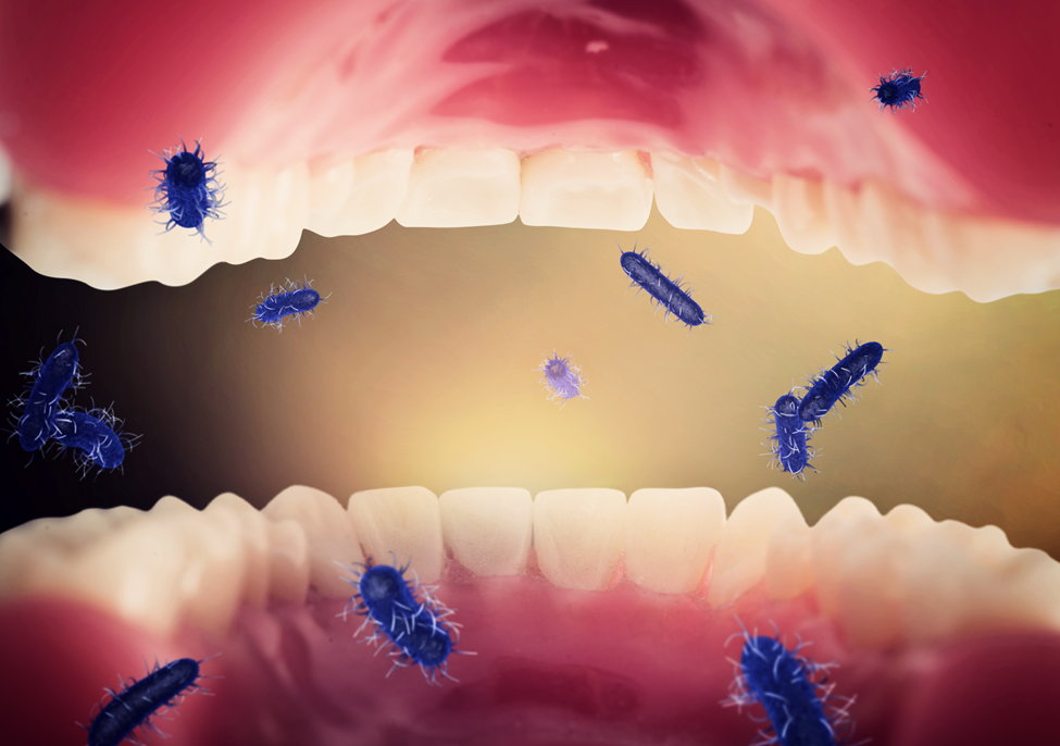 Protecting Your Smile from Cavity-Causing Bacteria | Evans Street Dental